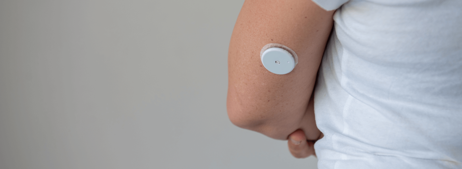 Bloedsuiker Sensor Traject Diëtistenpraktijk Stede Broec